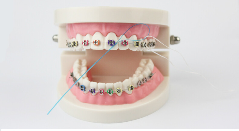 Dental Loop Floss Threader Orthodontic Braces Fixed Retainer Bridges ...