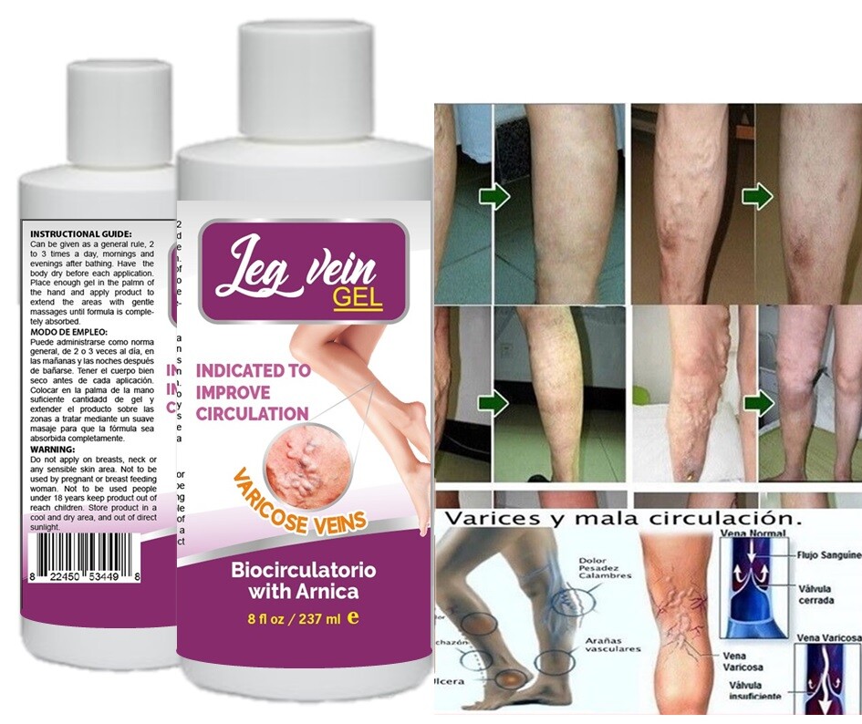 Support varicose spider supplement & gel cream varices veins duo ...