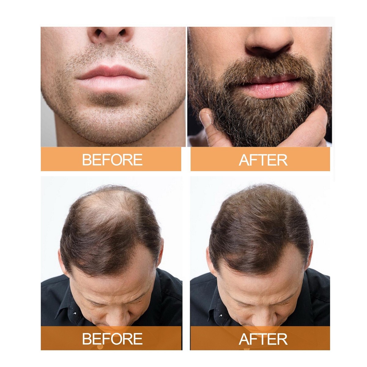 Dry Hair Before And After Men