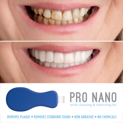 PRO NANO Teeth Whitening Kit Teeth Cleaning Whitener Strip Tooth Stains ...