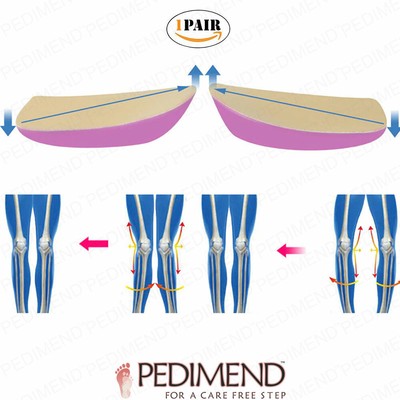 Knock-Knees Bow Legs Correction O/X Type Legs Insoles by PEDIMEND ...