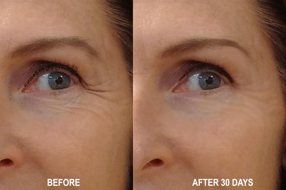 15 ml- DIY Argireline Peptide 100% Solution Serum Booster Add to Your ...