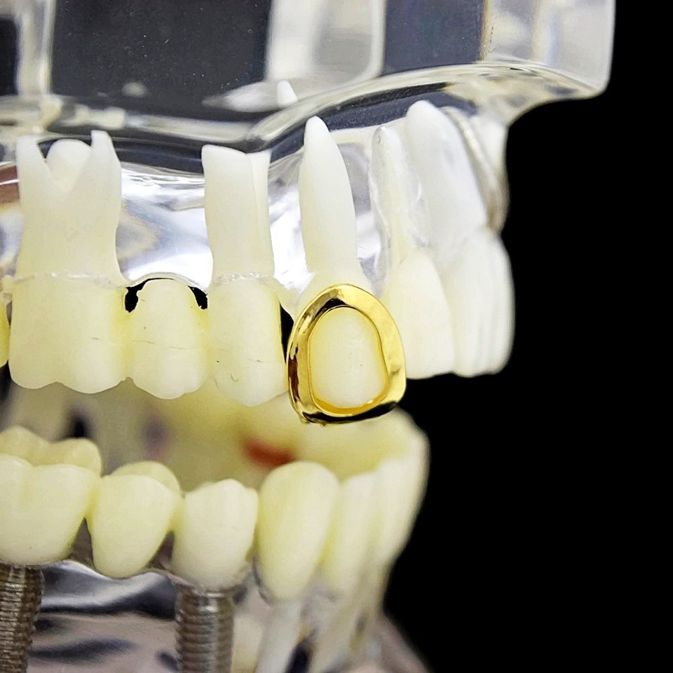 Open Face Grillz Single Cap 14k Gold Plated Hip Hop Tooth Top Grill w ...