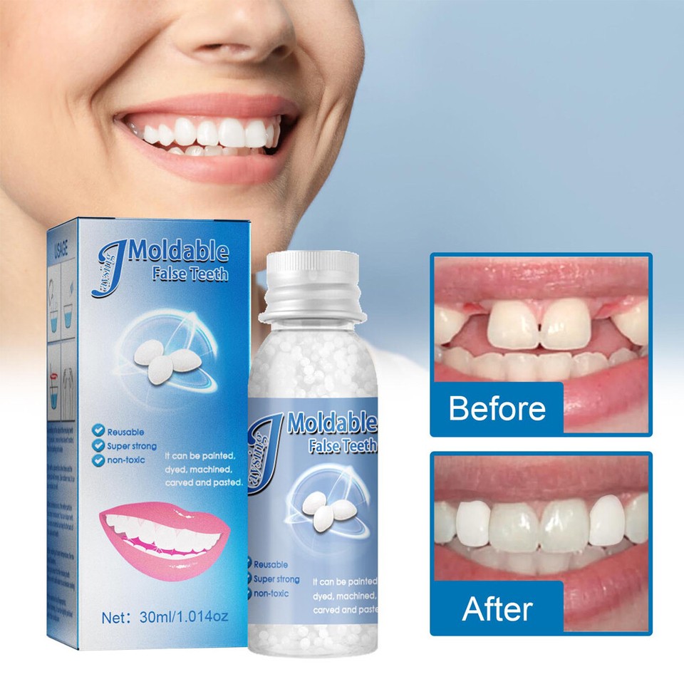 2PCS Tooth Repair Beads Granules,Temporary Moldable Dental Pellets ...