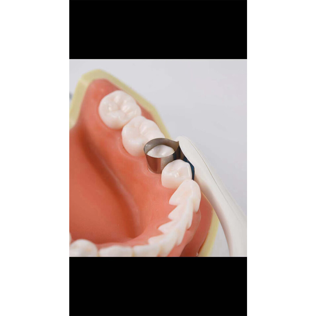 Professional Denture Reline Kit Dental Pro Matrix Bands Interproximal ...