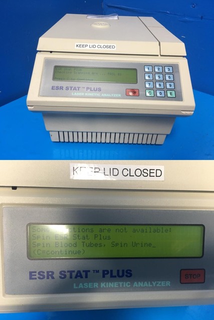 HemaTechnologies ESR STAT PLUS analyzer / Laser Kinetic Analyzer ...