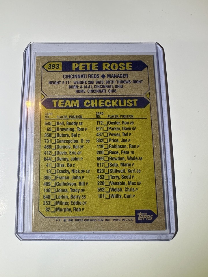 1987 Topps 393 Pete Rose Manager Card with Errors - Extremely Rare | eBay