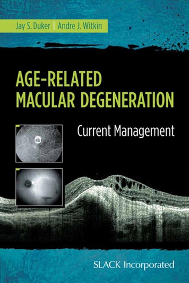Age-Related Macular Degeneration: Current Management by Jay Duker ...