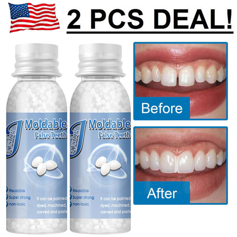 2PCS Tooth Repair Beads Granules,Temporary Moldable Dental Pellets ...