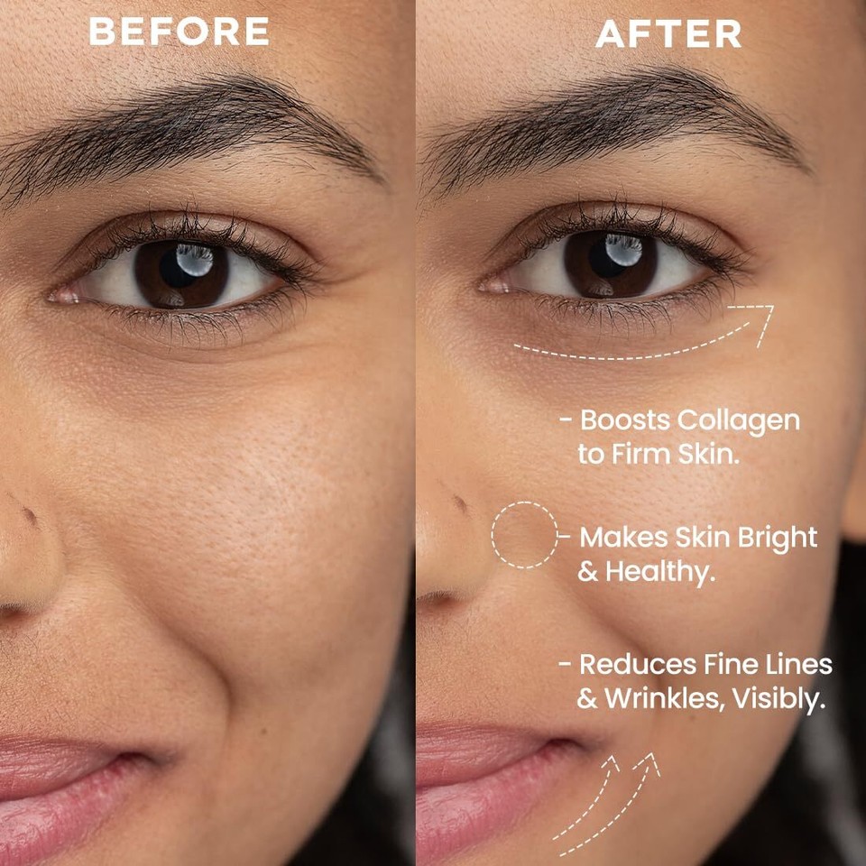 Hyphen Retinal Reset Serum For All Skin Types 30ml | eBay
