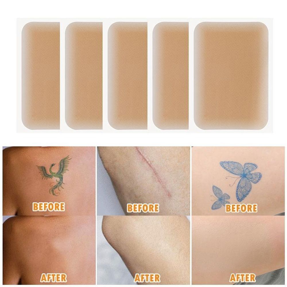 Concealing Concealer Tattoo Cover Up Sticker Skin-Friendly Scar Acne ...