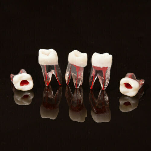 20Pc Dental Tooth Endo Root Canal Study Model RCT Practice Block Pulp ...