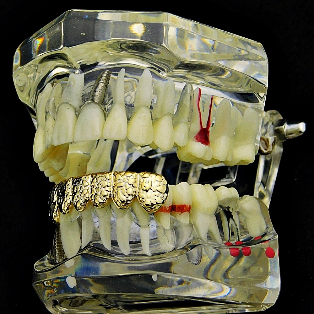 Nugget Grillz 14k Gold Plated Bottom Teeth 6 Piece Slugs Hip Hop Mouth ...