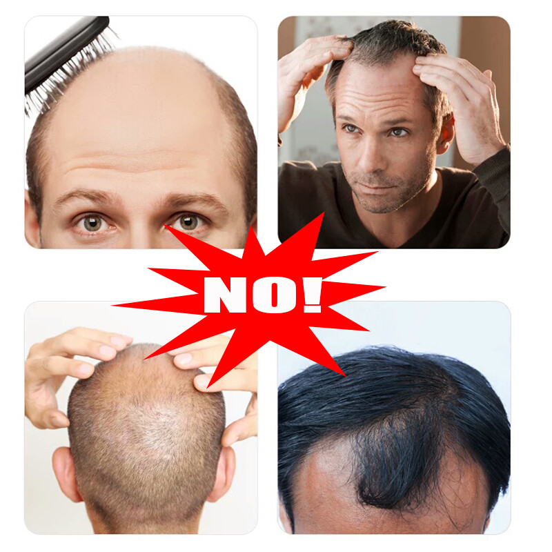 INVISIBLE Remy Human Hairline Hair System For Bald Men Wig Toupee ...