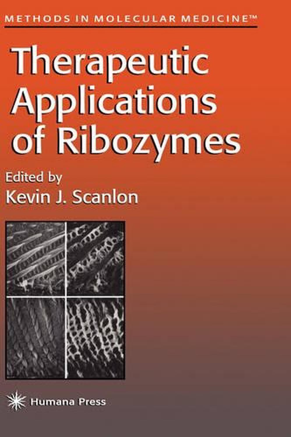 Therapeutic Applications of Ribozymes by Kevin J. Scanlon (English ...