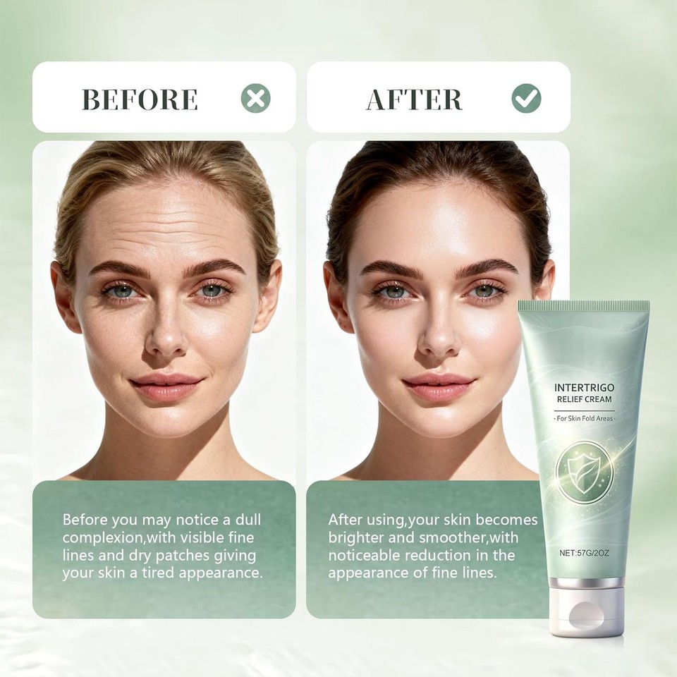 1-3PACK Healora Intertrigo Cream, Professional Intertrigo Relief Cream ...