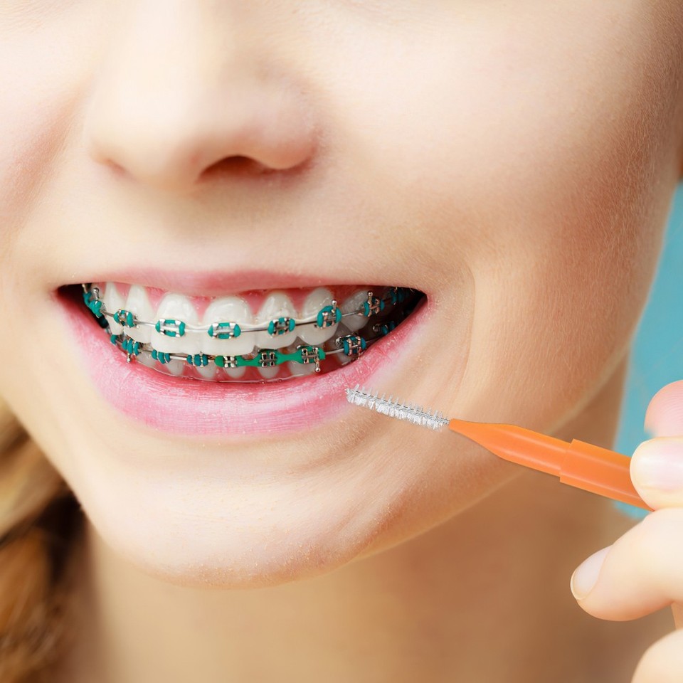 100 Pcs Small Tools Healthy Portable Braces Toothpicks Brushes | eBay