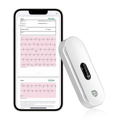 Personal EKG Monitor Heart Rate Monitor Bluetooth App data Recording ...