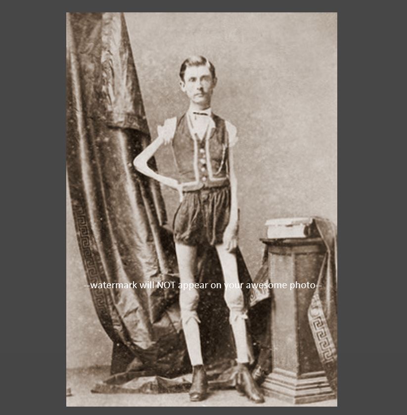 Vintage Circus Freak Living Skeleton PHOTO Thin Man PT Barnum 1867 ...