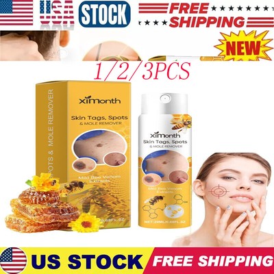 TagRecede Bee Venom Spray, 1-3 Pack Tag Recede Bee Venom Treatment ...