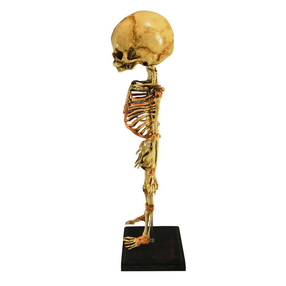 Aged Fetus Skeleton Medical Specimen Display Oddity Skull Bone ...