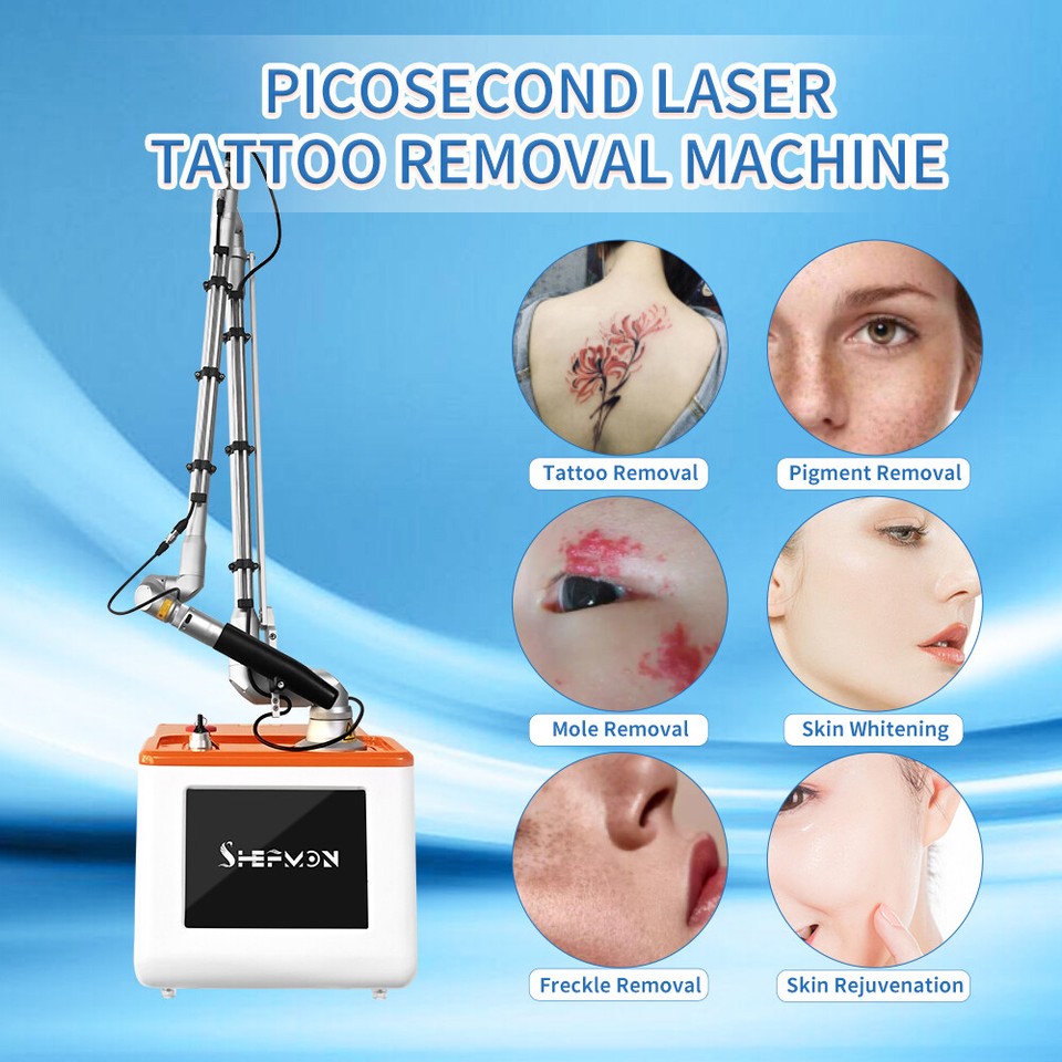 Picosecond Laser Tattoo Removal Machine Pico Carbon Peel Remove Pigment ...