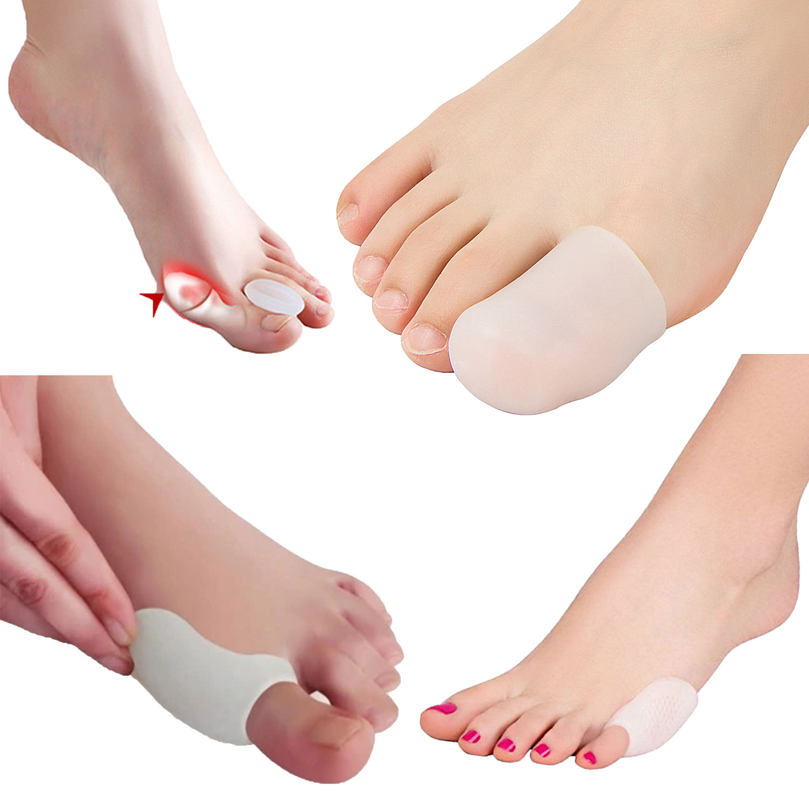 Pedimend™ Silicone Toe Sleeve for Pinky Toes, Toe Caps, Big Toe Bunion ...