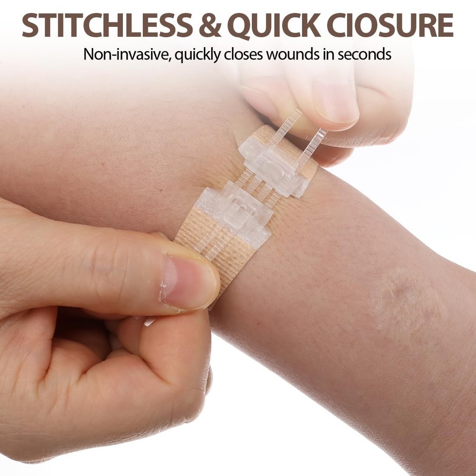 Wound Closure Strips, Emergency Laceration Closures Butterfly Stitches ...