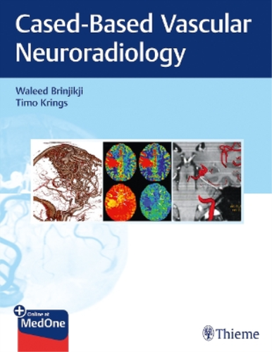 Timo Krings Waleed Brinjik Imaging in Neurovascular Disea (Mixed Media ...