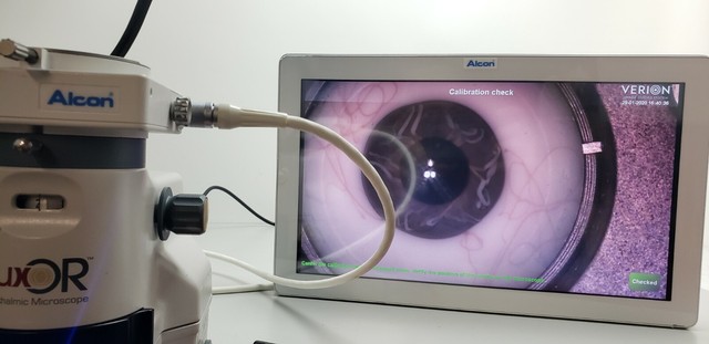 Alcon Parts OF Verion Digital marker MID REF X-MID Wavelight digital ...