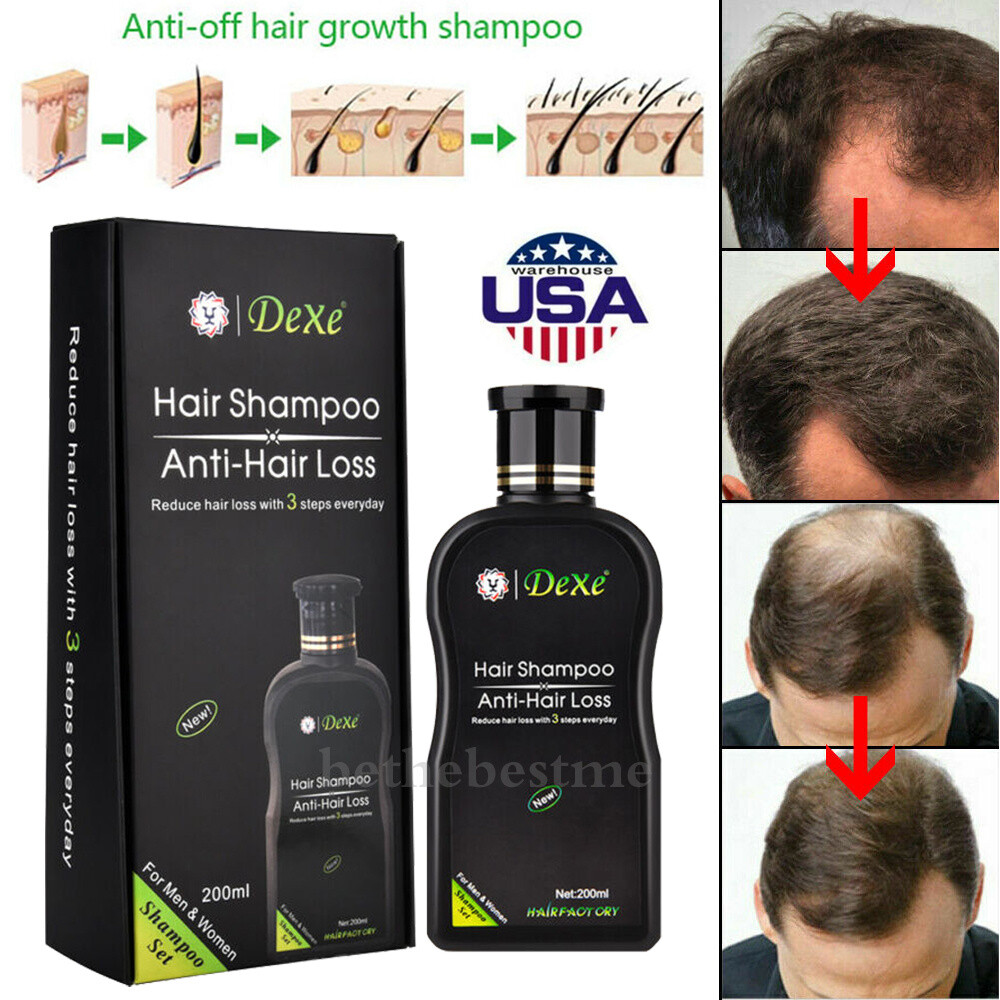 200ml Regeneration Regrowth Hair Growth Shampoo Natural Anti Hair Loss ...