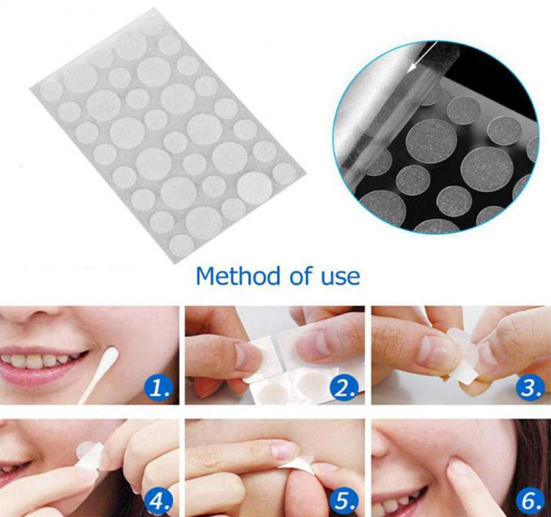 36 Pcs Acne Pimple Plasters Patch Removal Blemish Control Skin Facial ...
