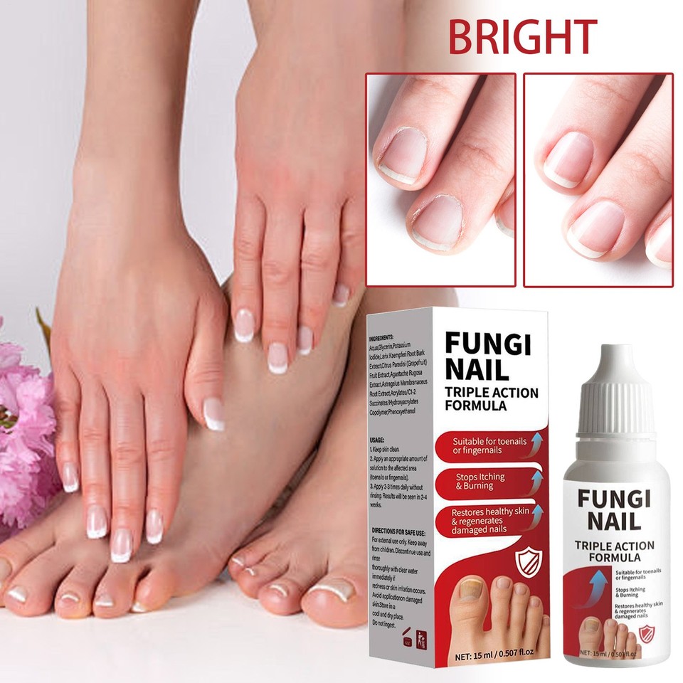 Fungi Nail Anti Fungal Liquid Triple Action Formula Nail Repair Liquid ...