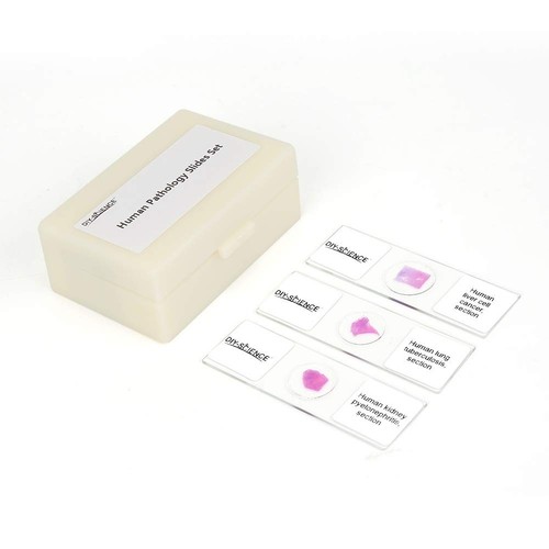 Prepared Human Pathology Microscope Slide Set, 12pcs Research-Quality ...