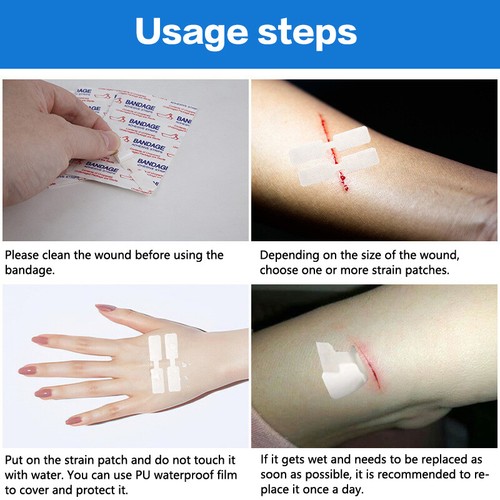 10Pcs Zipper Band-aid Painless Wound Closure Device Suture-free Wound ...