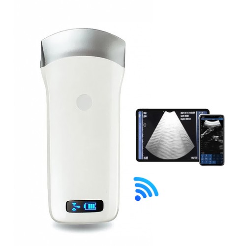 Portable 80/64 element Wireless Ultrasound Scanner Machine Android iOS ...