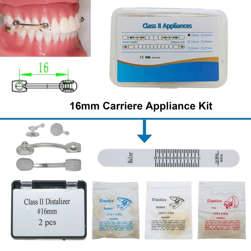 Orthodontic Treatment Carriere Motion Class II Appliances Distalizer ...