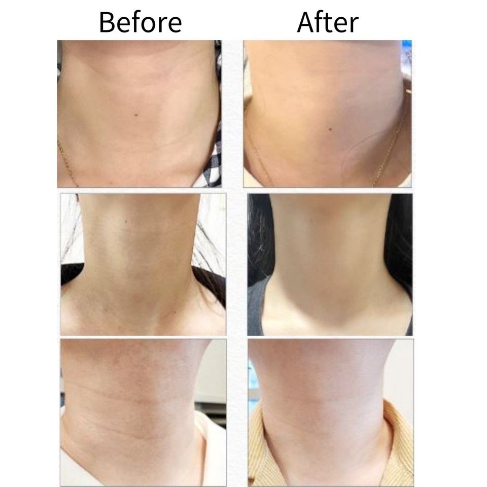 Arocell Super Neck Wrinkles Cream 80ml with Qua Sha Age Anti-Agining ...