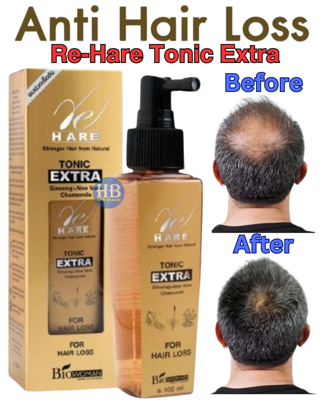Anti-hair Loss Tonic Extra Fast Growth, Ginseng, Aloe Vera Hair ...