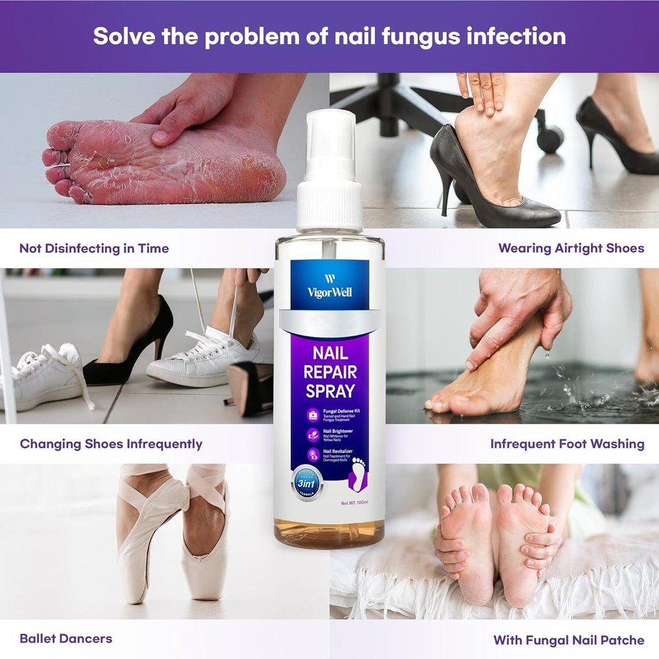 Toenail Fungus Treatment Spray, Extra Strength Nail Fungus Treatment ...