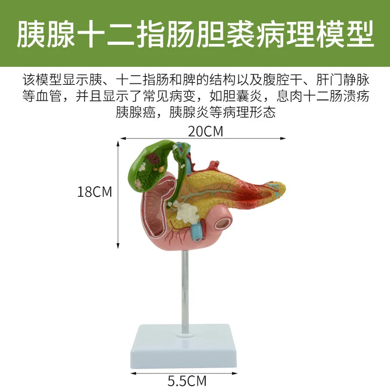 Highly Simulated Liver Anatomy Model Liver Gallbladder Pancreas Spleen ...