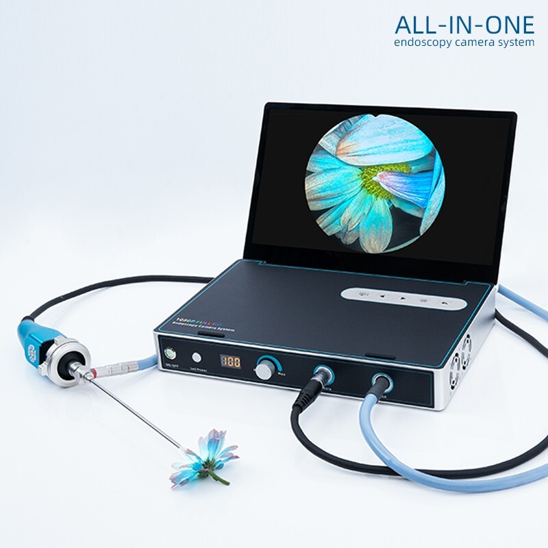 Portable Medical ENT Endoscope Camera 1080P FHD With Light Source For ...