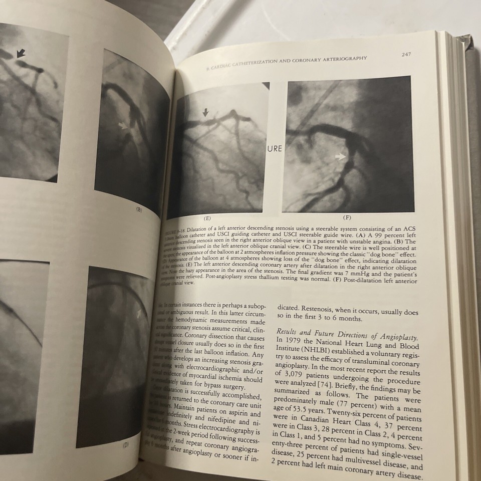 Diagnosis and Therapy of Coronary Artery Disease by Peter Cohn - 1987 ...