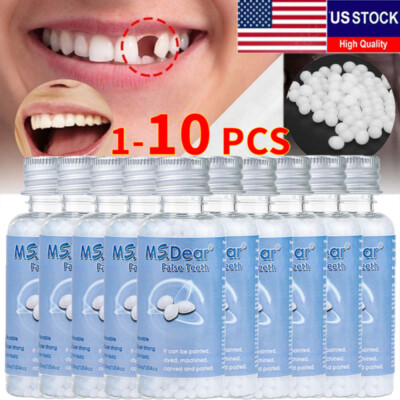 Strong Teeth Tooth Repair Temporary Dental Cement Cavity Filling Kit ...