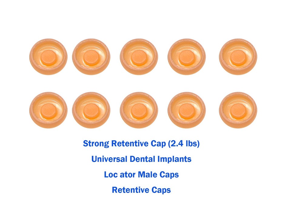 Loc-In Implant Abutment Male Caps Kit & Dental Abutment Tool For ...