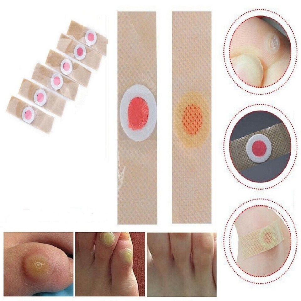 12Pcs Foot Corn Removal Pads Hole Plantar Plaster Patches Warts Thorn ...