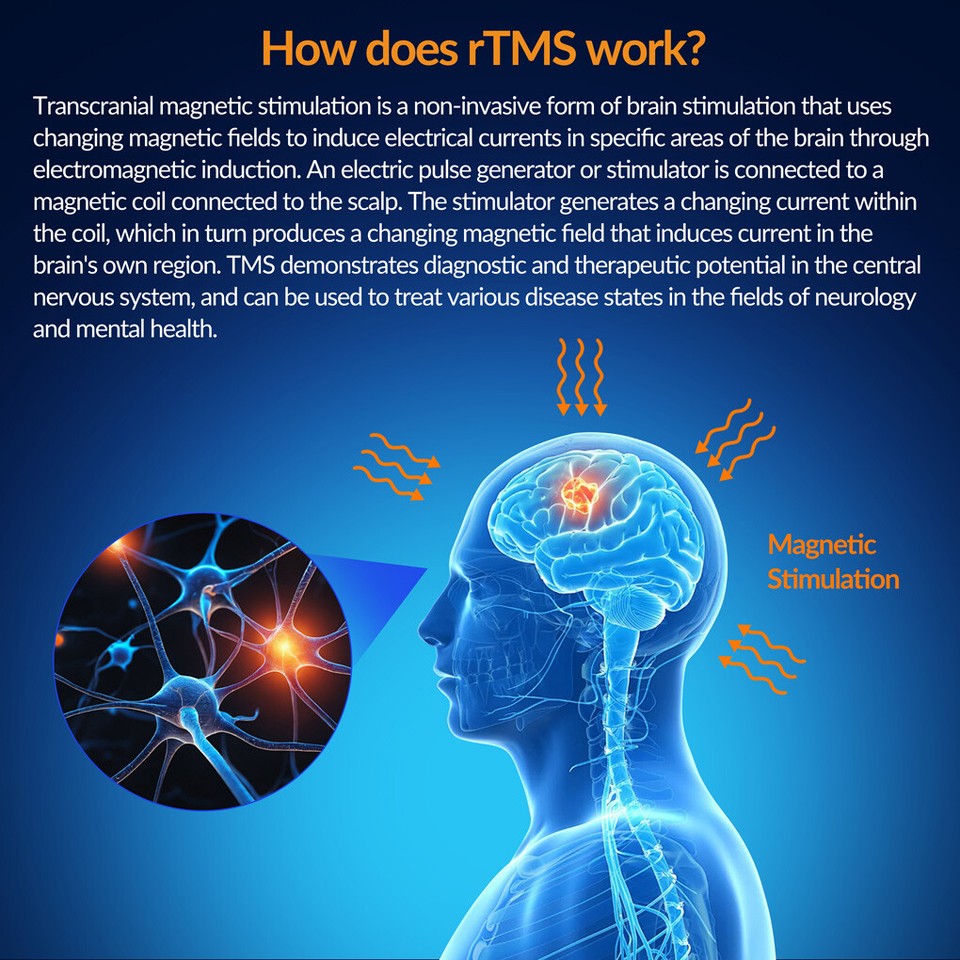 TMS Head Massager Parkinson Cerebral Infarction Transcranial Magnetic ...