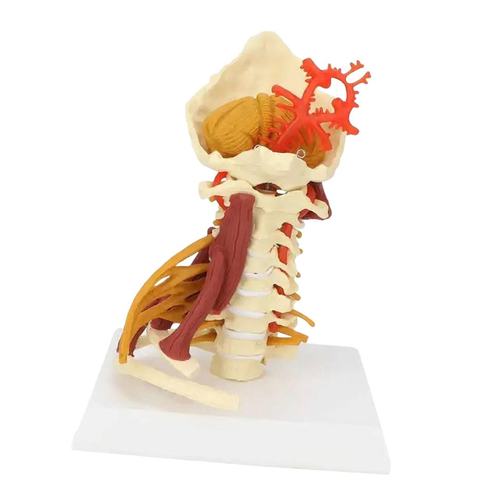 Spinal Column Model, Cervical Vertebra Model, Arterial Spine Model ...
