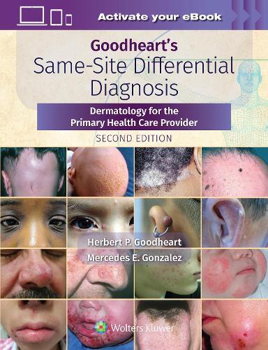 Herbert Goodhea Goodheart's Same-Site Differenti (Gebundene Ausgabe ...