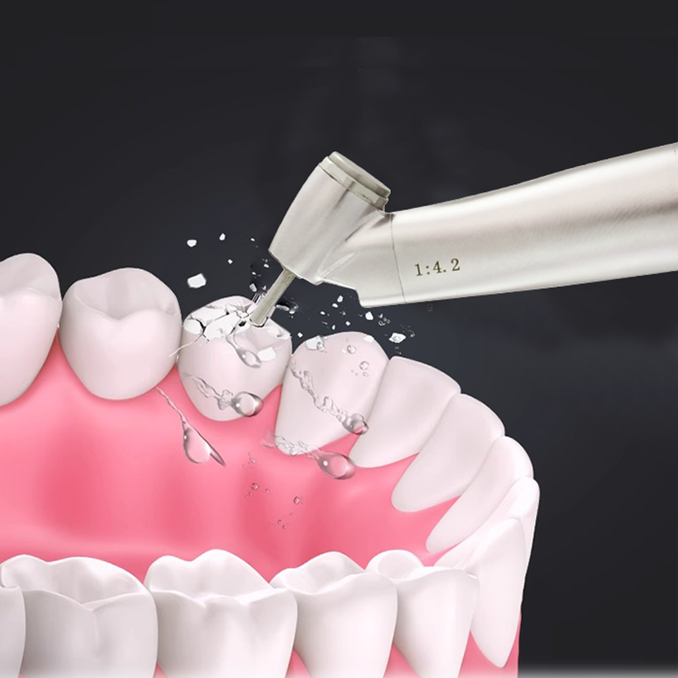 Dental 45° Contra Angle Fiber Optic LED 1:4.2 Increasing Surgical ...